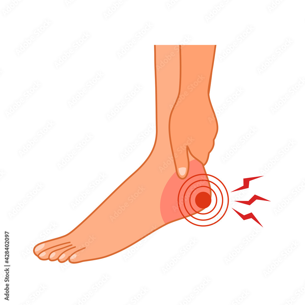 Foot pain concept vector illustration on white background. Man or woman ...