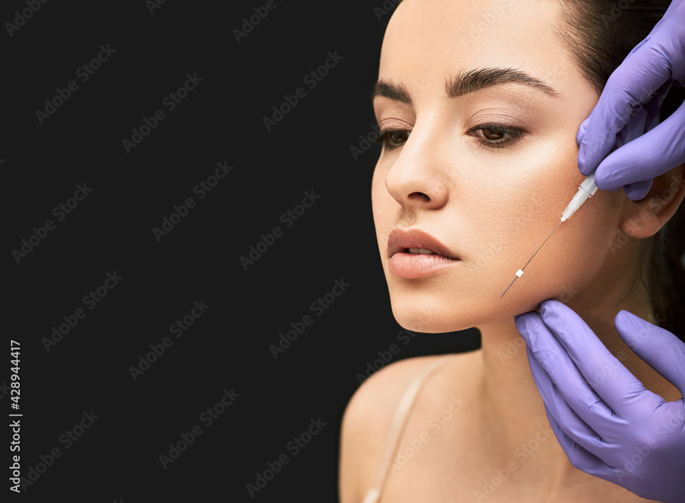 Mesothreads facial. Needle with meso threads near a female face over a ...