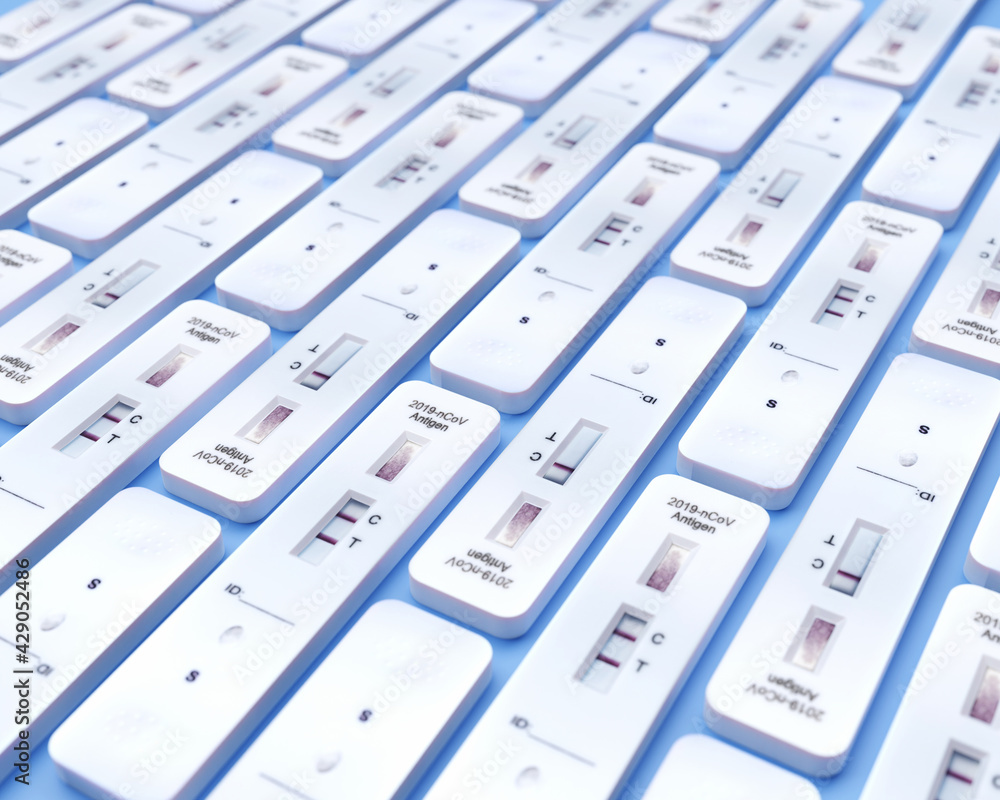 Lots of positive and negative Results for COVID-19 with test kit. Lab ...