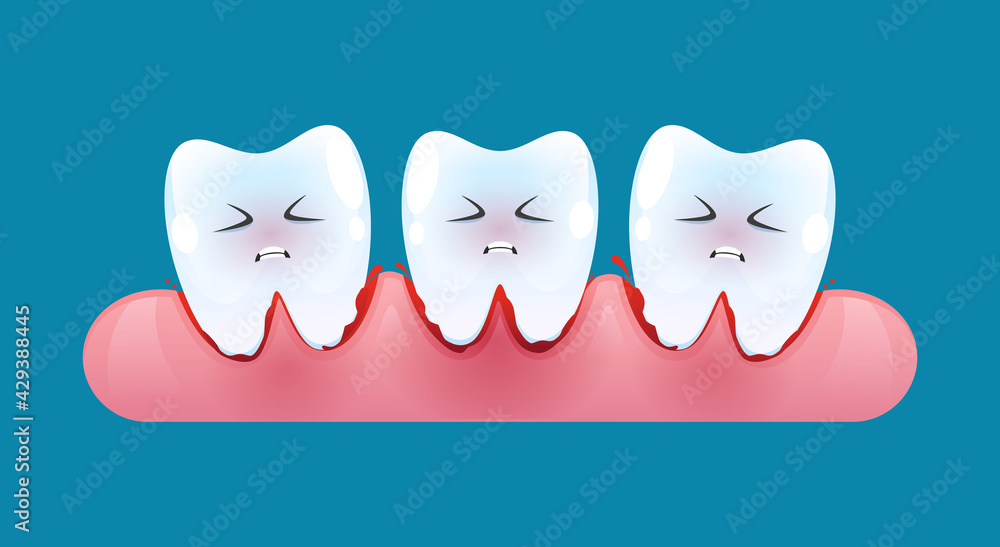 Tooth is bleeding in the gum. Blood teeth. Vector cartoon style. Stock ...