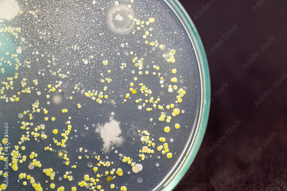 Backgrounds of Characteristics and Different shaped Colony of Bacteria ...