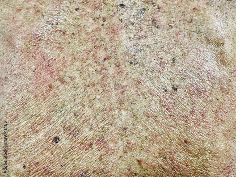 The texture of old man's skin. Can see the details of the skin color ...