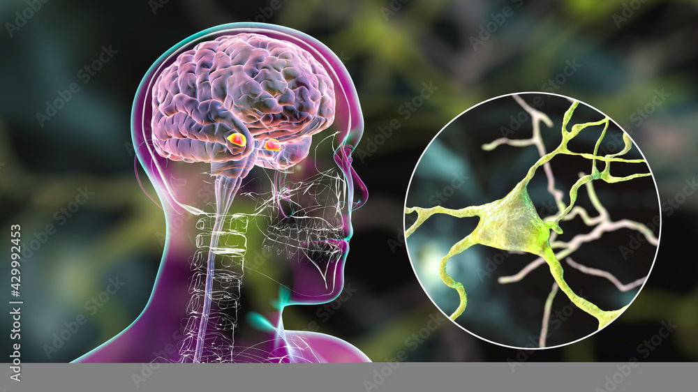Amygdala in the brain, and closeup view of amygdala neurons, 3D ...