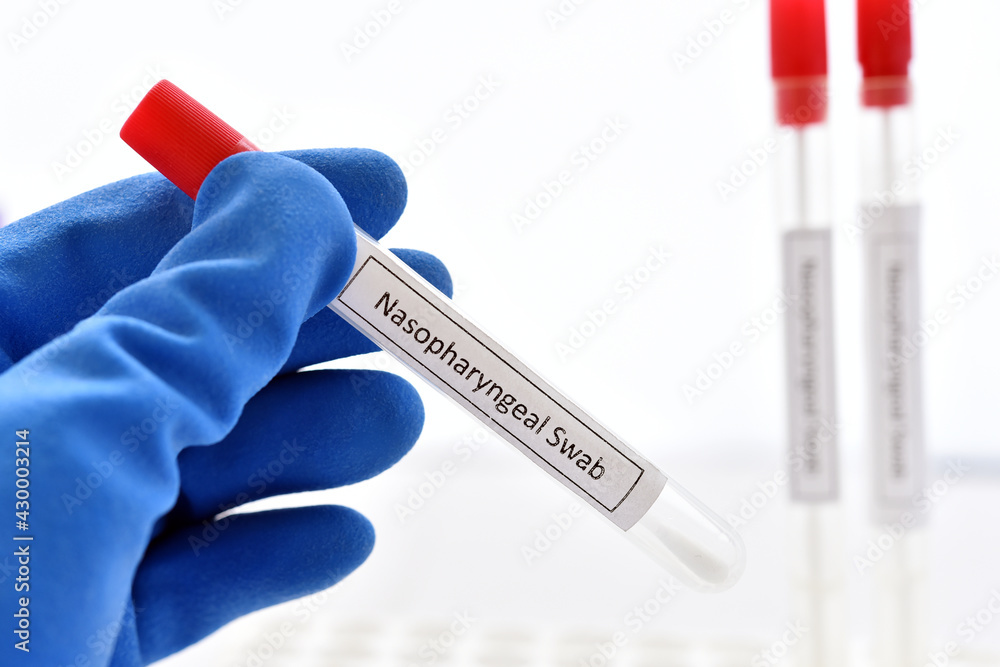 Test tube with nasopharyngeal swab from patient for COVID-19 testing by ...