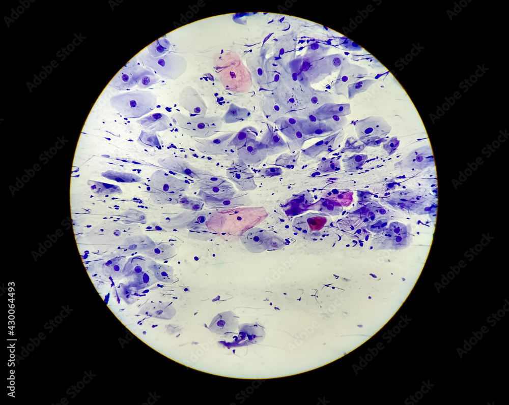 Conventional pap smear microscopic image of Endocervical cells and ...