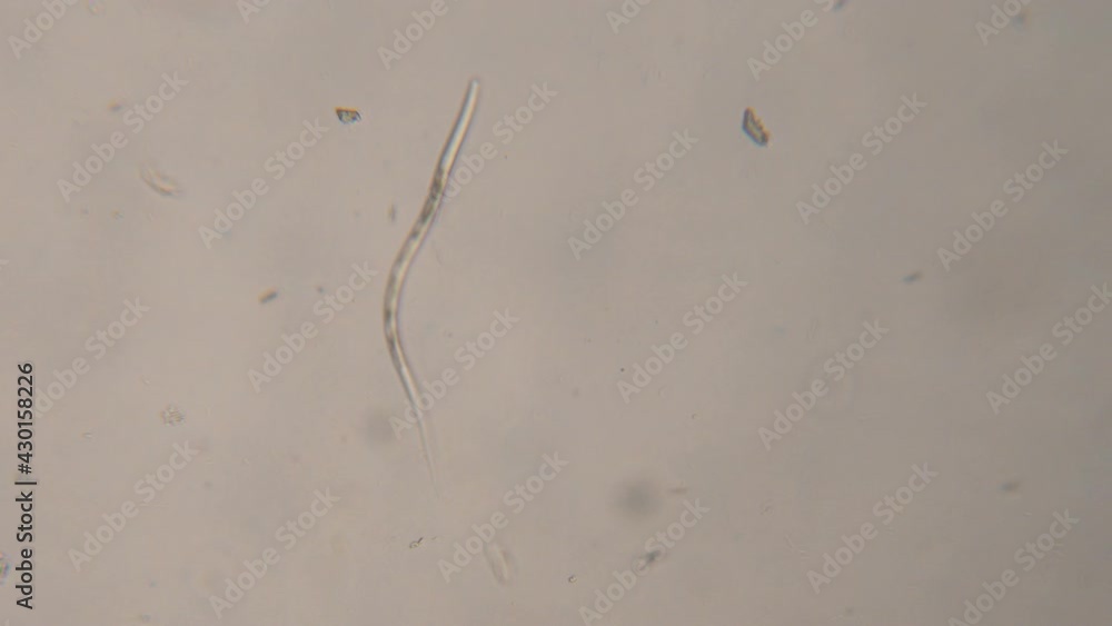 Bacteria Parasites and Worms in drinking Water under Microscope ...