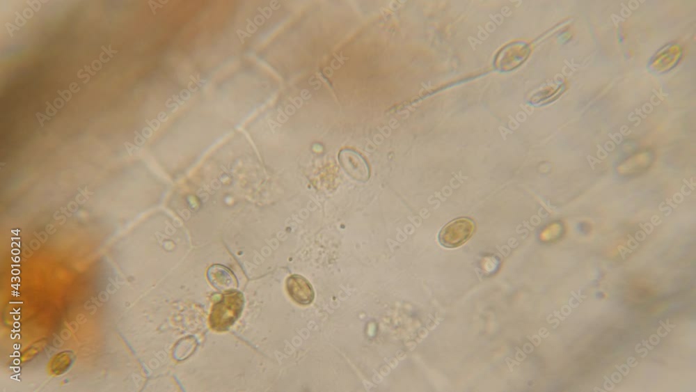 Chloroplast Under a Microscope Dead Plant. Cell Division. Dead Plant ...