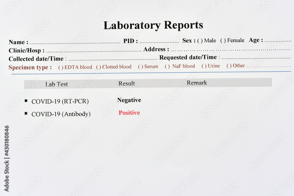 COVID-19 test results by using RT-PCR method and rapid test antibody ...