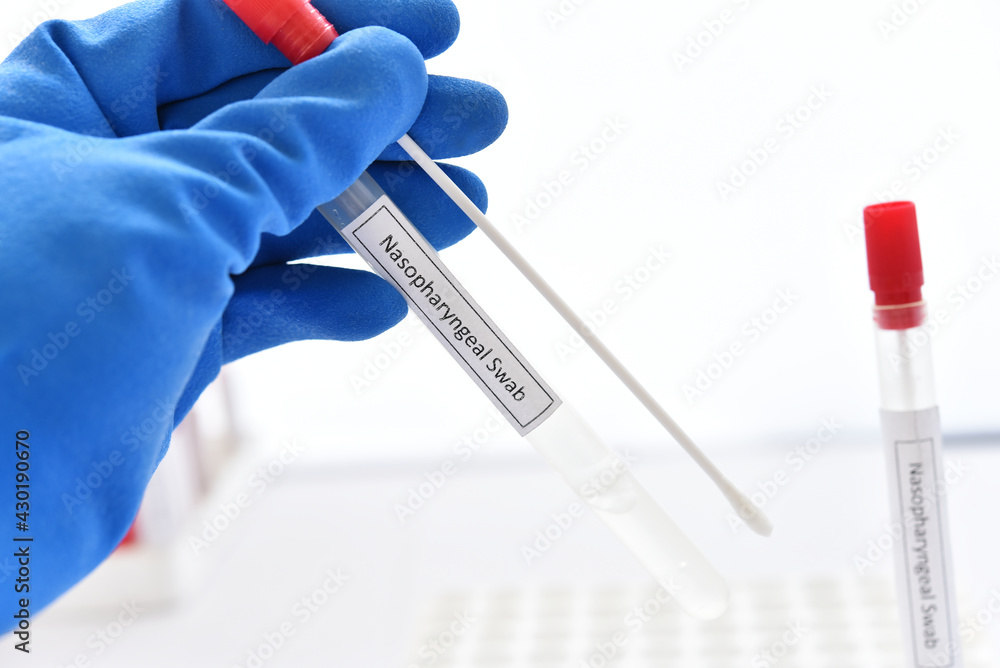 Nasopharyngeal swab from patient for COVID-19 testing by RT-PCR method ...
