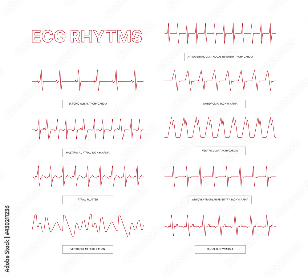 Ecg templates. Medical infographic lines heart arrhythmia health ...