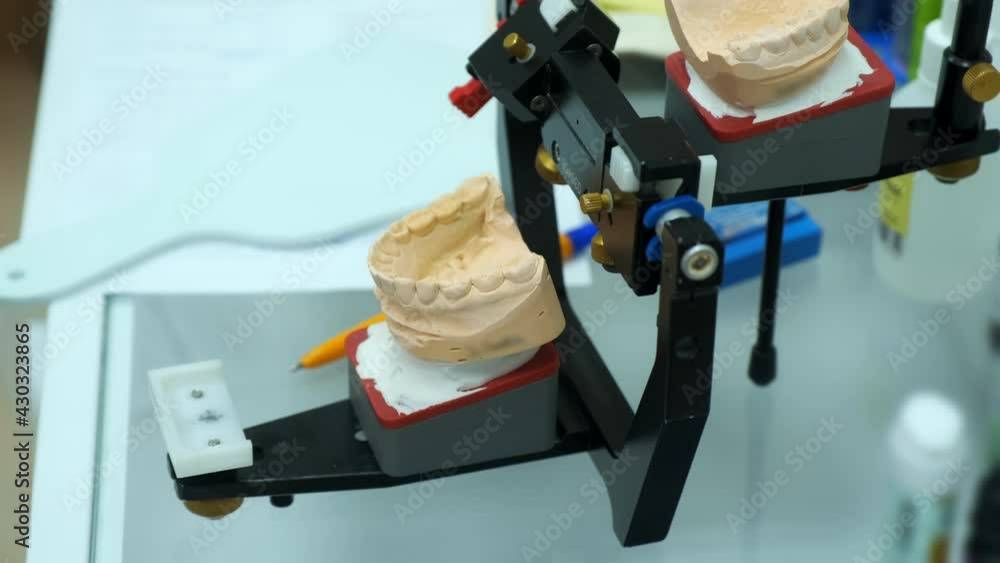 Model of human jaws from plaster to prosthesis the teeth, orthodontist ...