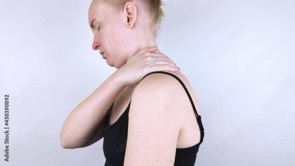 Kyphosis. The woman suffers from a curvature of the spine in the upper ...