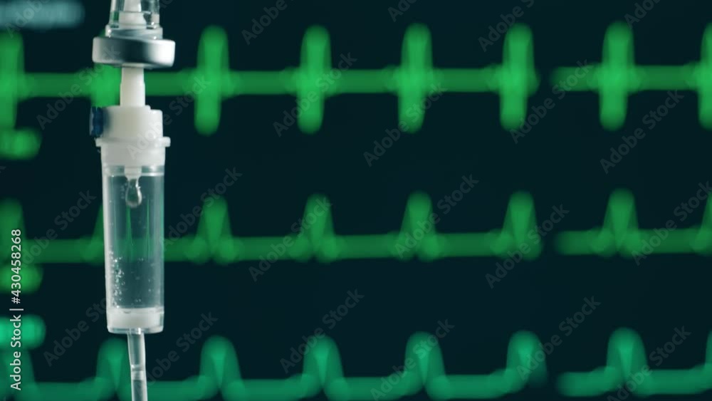 Iv drip on the background of monitoring ECG. Patient in operating ...