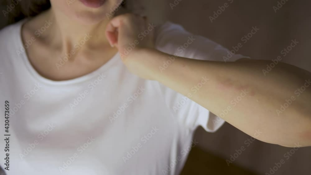Woman suffering from itching on her skin and scratching an itchy place ...