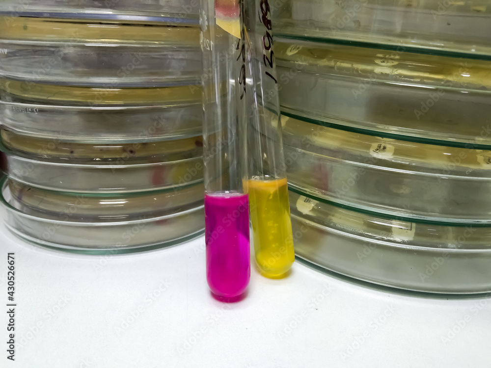 Urea Agar