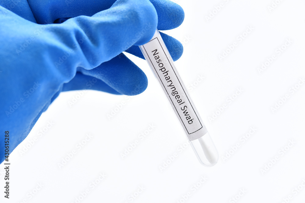 Nasopharyngeal swab from patient for COVID-19 test by using RT-PCR ...