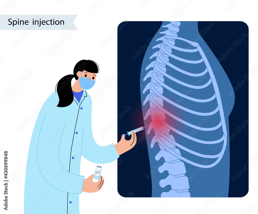 Spine joint injection Stock Vector | Adobe Stock