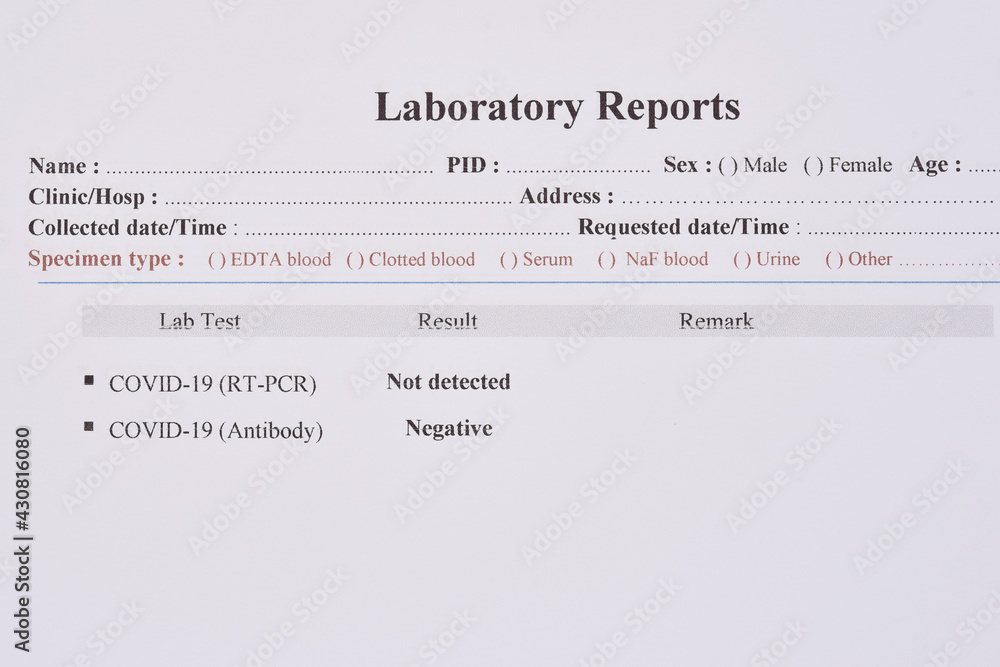 COVID-19 test results by using RT-PCR method and rapid test antibody ...
