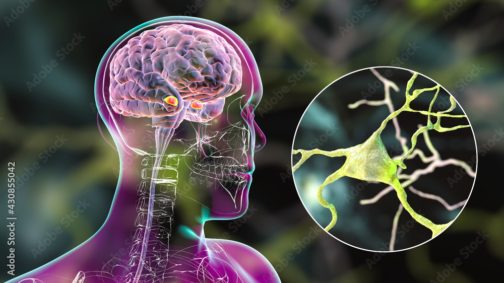 Amygdala in the brain, and closeup view of amygdala neurons, 3D ...