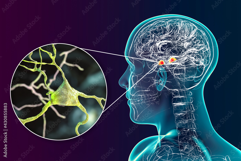 Amygdala in the brain, and closeup view of amygdala neurons, 3D ...