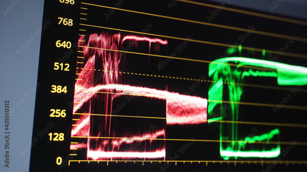 Color grading indicator graph on screen. RGB colour correction graphic ...