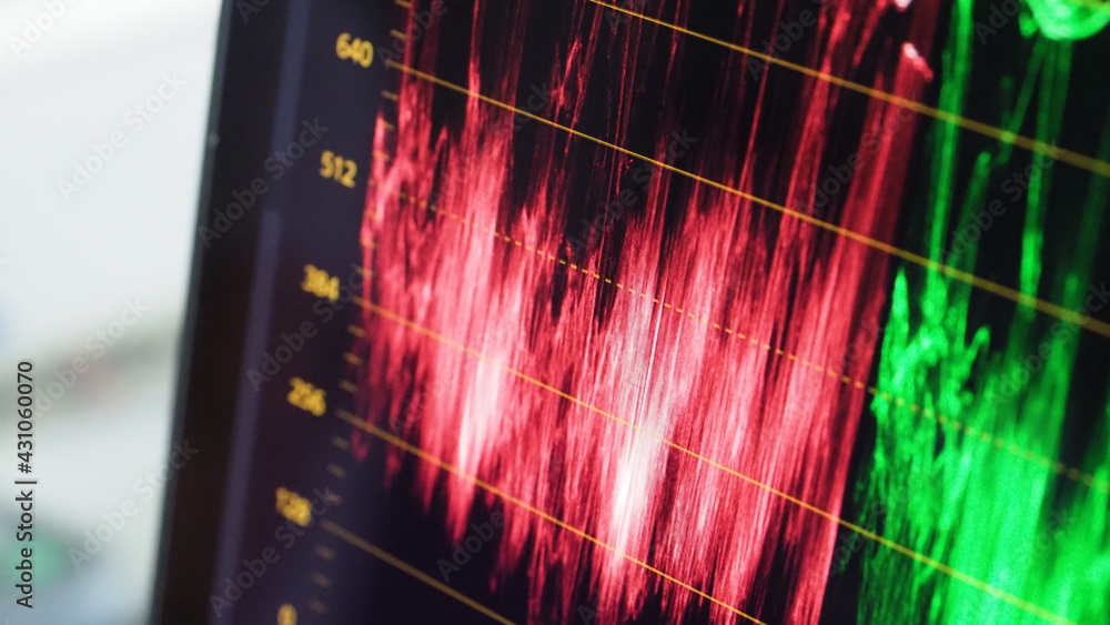 Color grading indicator graph on screen. RGB colour correction graphic ...