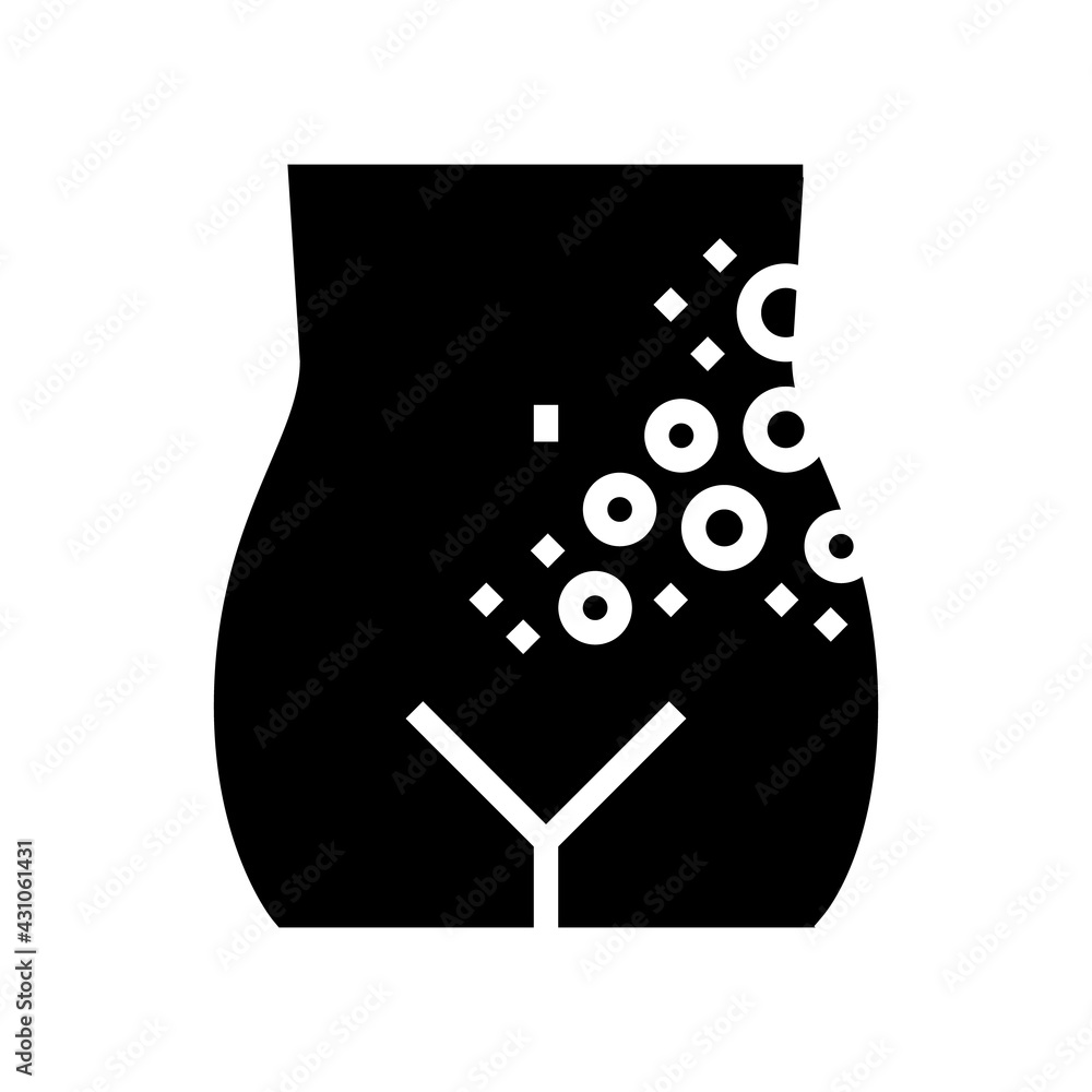 lichen shingles disease glyph icon vector. lichen shingles disease sign ...