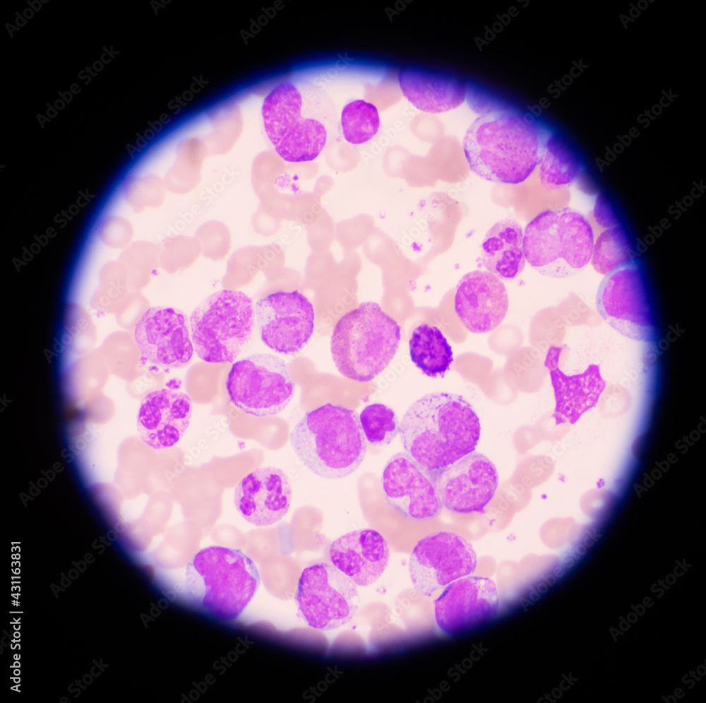 Foto de Mixed stage white blood cell on red cells background. do Stock ...