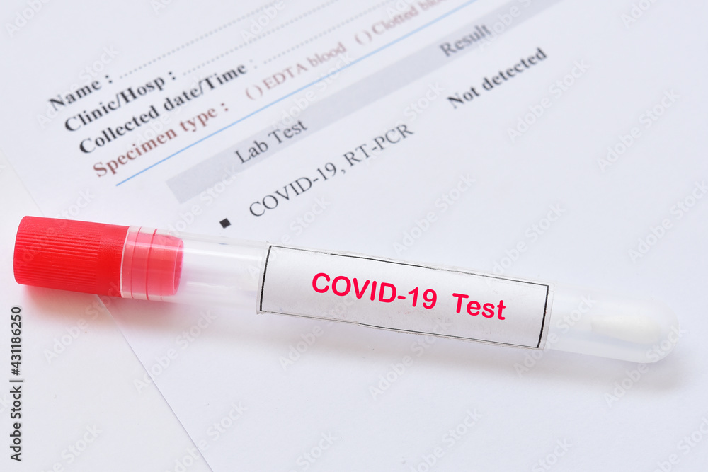 Nasopharyngeal swab not detected with COVID-19 test by using RT-PCR ...