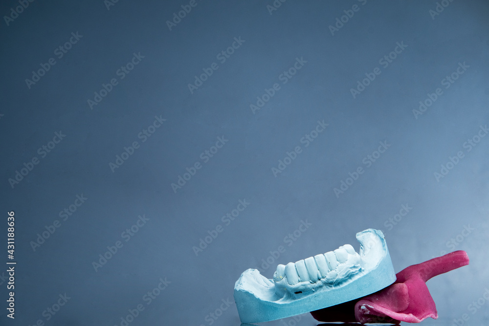 Clay matrix for prosthetic dental treatment. Dentist technology Stock ...