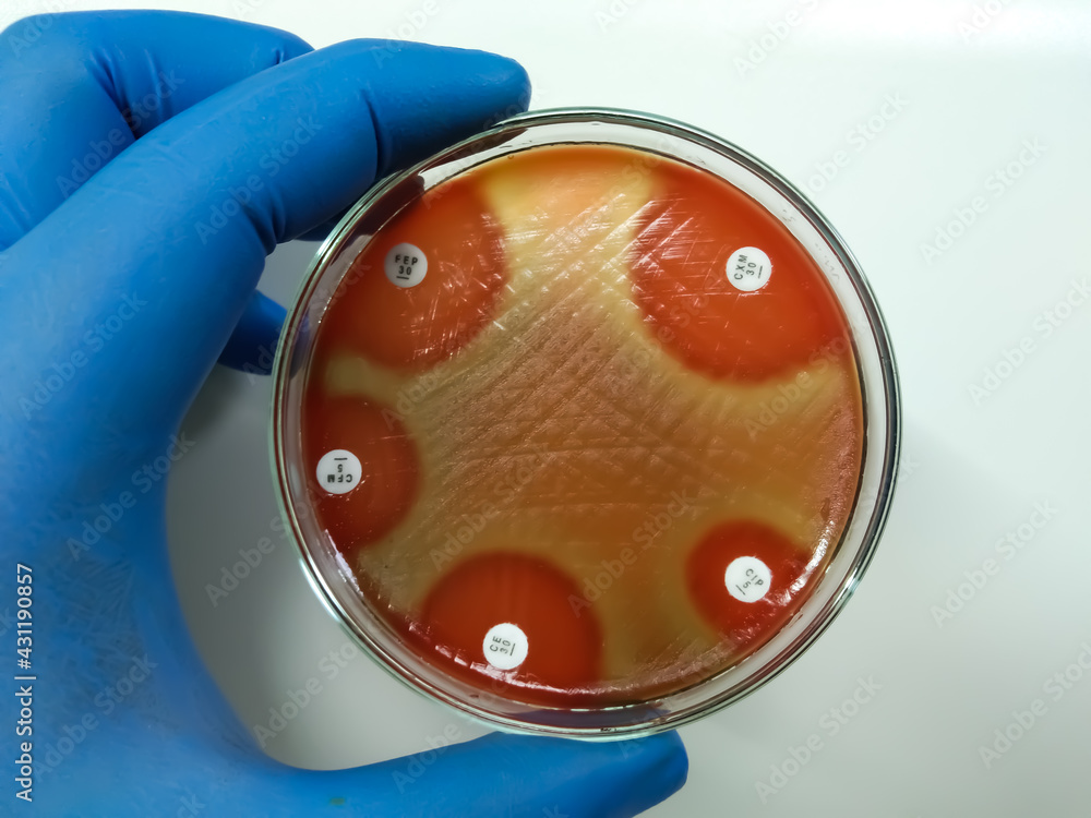 Antimicrobial susceptibility testing in petri dish : Streptococcus ...