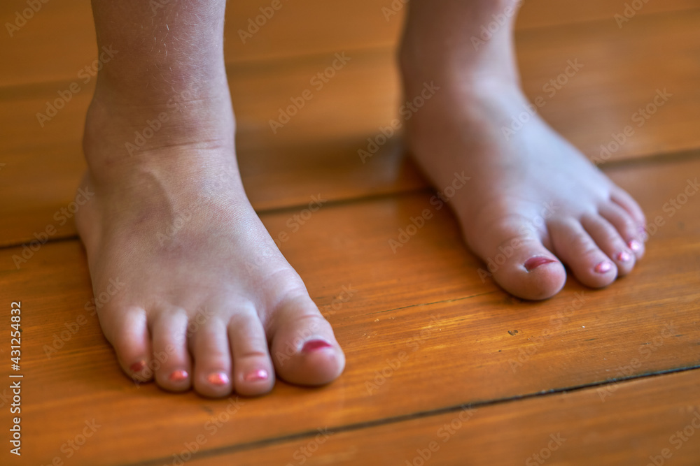 Little baby feet with painted nails. Pedicure for children. Little girl ...