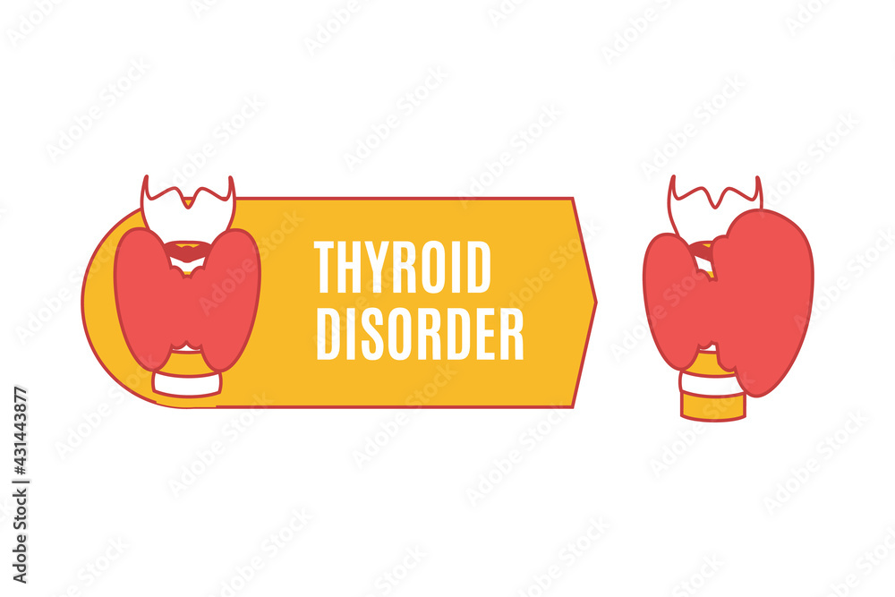 Vetor de Healthy thyroid gland versus hyperthyroidism landing web page ...