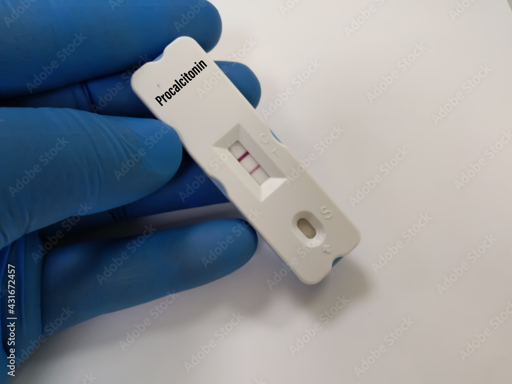 Scientist hold a test device or cassette for Procalcitonin test. Rapid ...