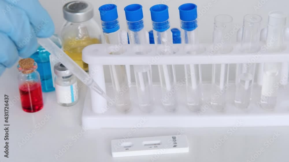 antigenic test cassette, glass tubes with reagents, a laboratory ...