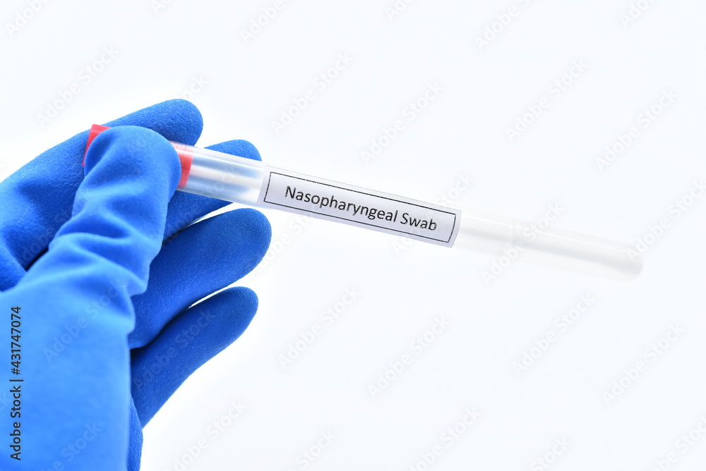 Nasopharyngeal swab from patient for COVID-19 testing by RT-PCR method ...
