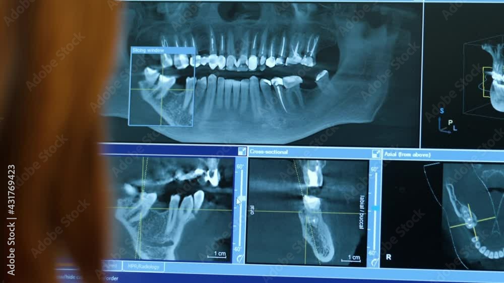 Close-up of doctor dentist looks at x-rays of the patient's jaw and ...