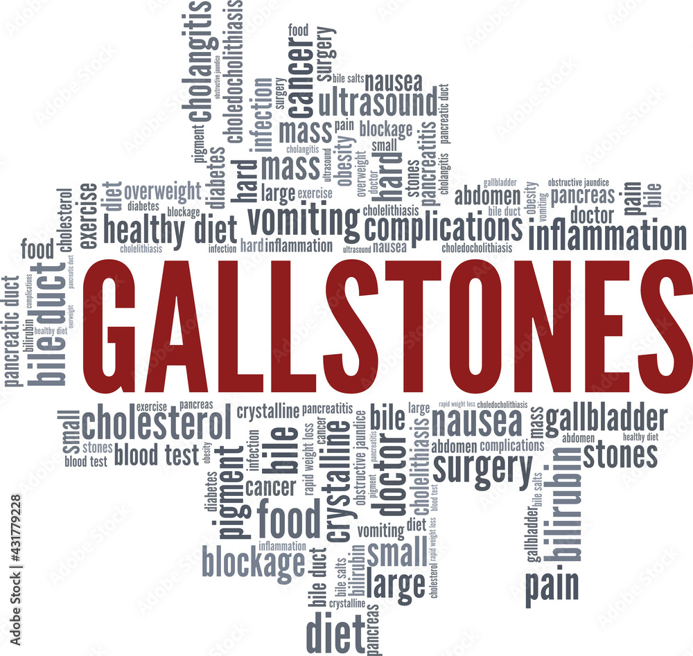 Gallstones vector illustration word cloud isolated on a white ...