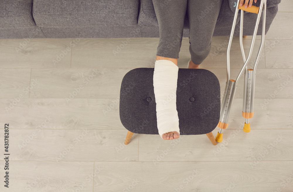 Female broken injured leg relaxing on stool in cast and metal crutches ...