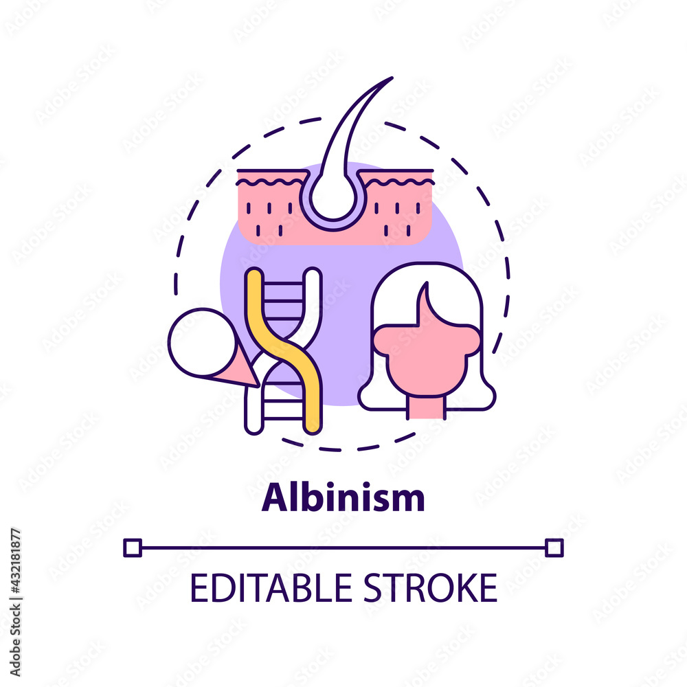 Albinism Genetics Disorder