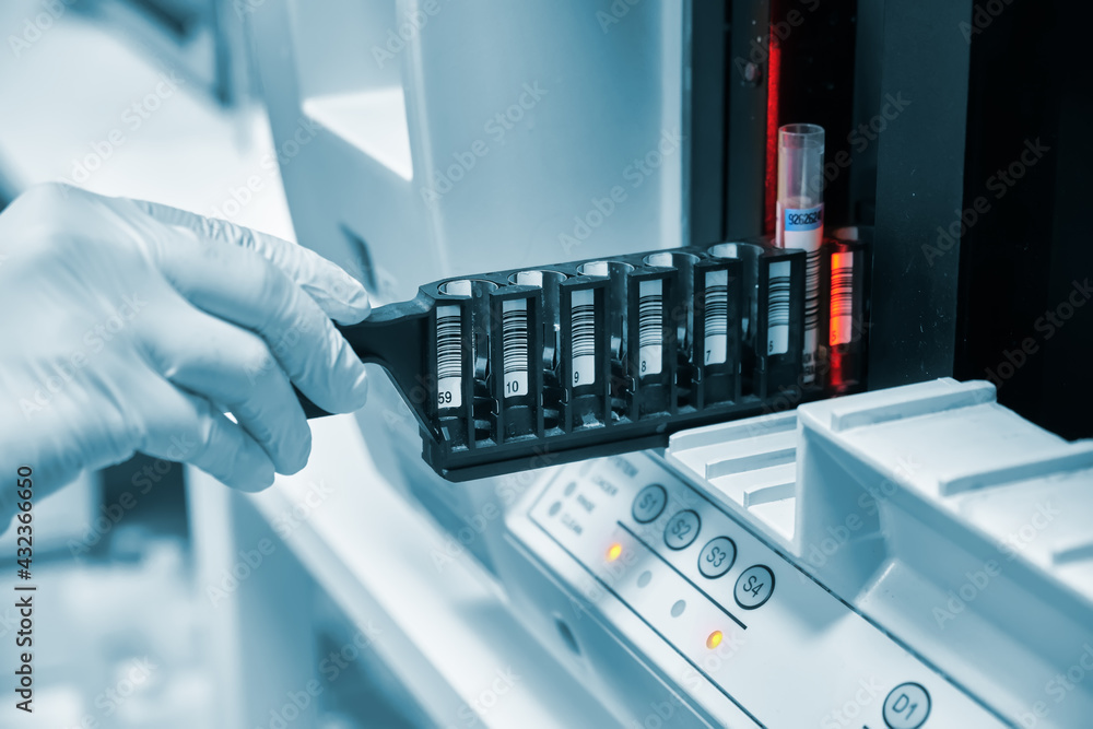 High-tech analysis equipment with laser light and biological samples ...