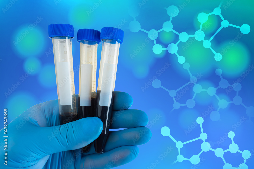 Test tubes with human blood in hand. Symbols Ribonucleic acid DNA as a ...