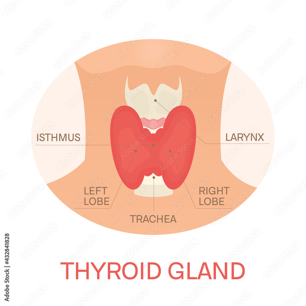 Thyroid gland and trachea shown on a silhouette of a woman. Body ...