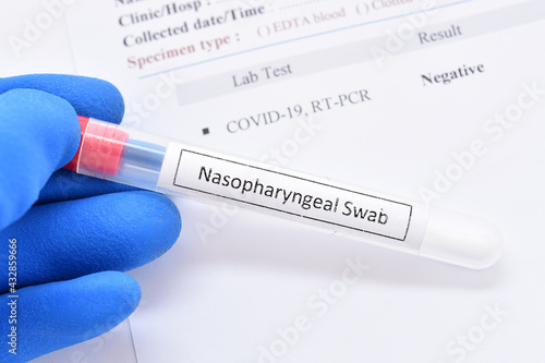 Nasopharyngeal swab positive with COVID-19 test by using RT-PCR method ...
