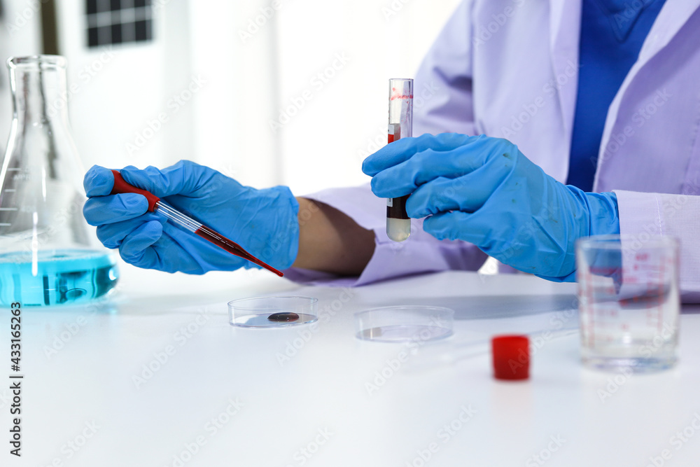 Scientist holding Coronavirus covid-19 infected blood sample tube DNA ...