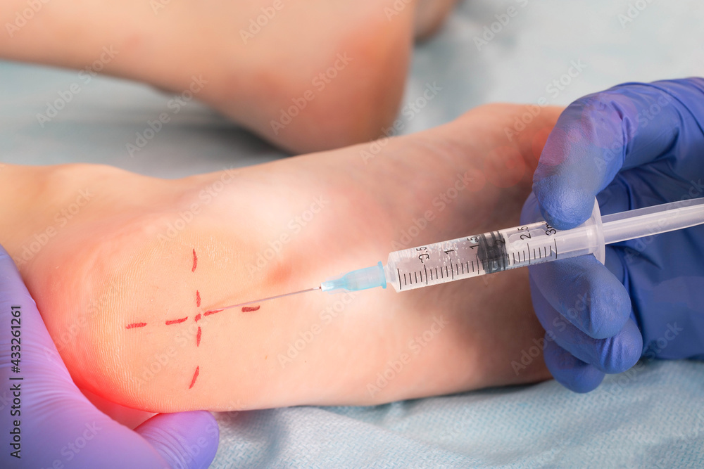 Medical injection with a medicine in the heel of the patient's foot ...