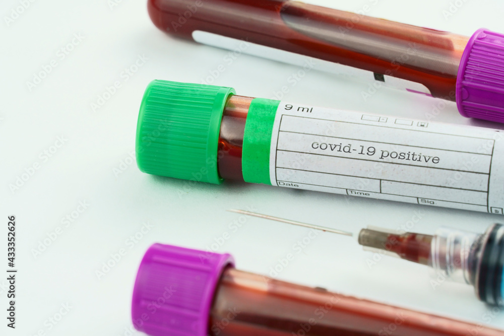 Vacuum tubes for collection and blood samples and a syringe on white ...