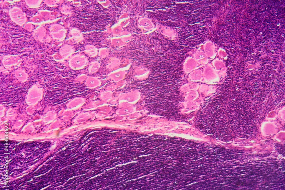 Longitudinal section of human spinal ganglion cells under the ...