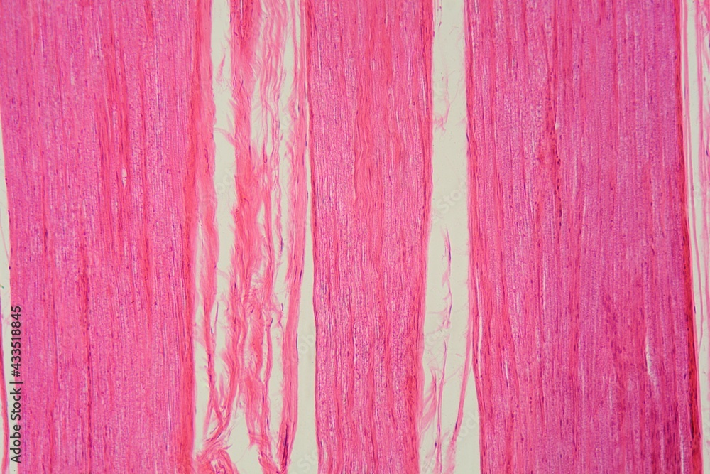 Longitudinal section of human nerve cells under the microscope. Stock ...