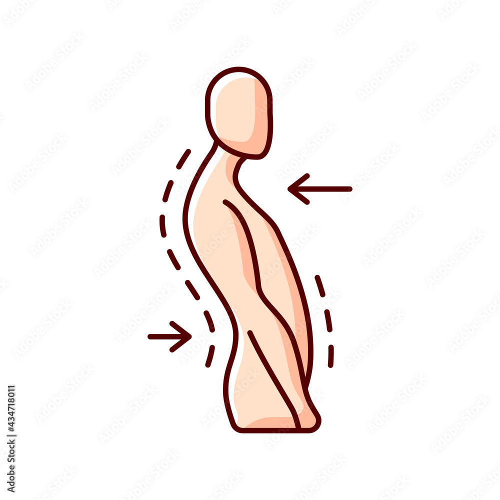 Swayback posture RGB color icon. Spine curvature disorder. Poor posture ...